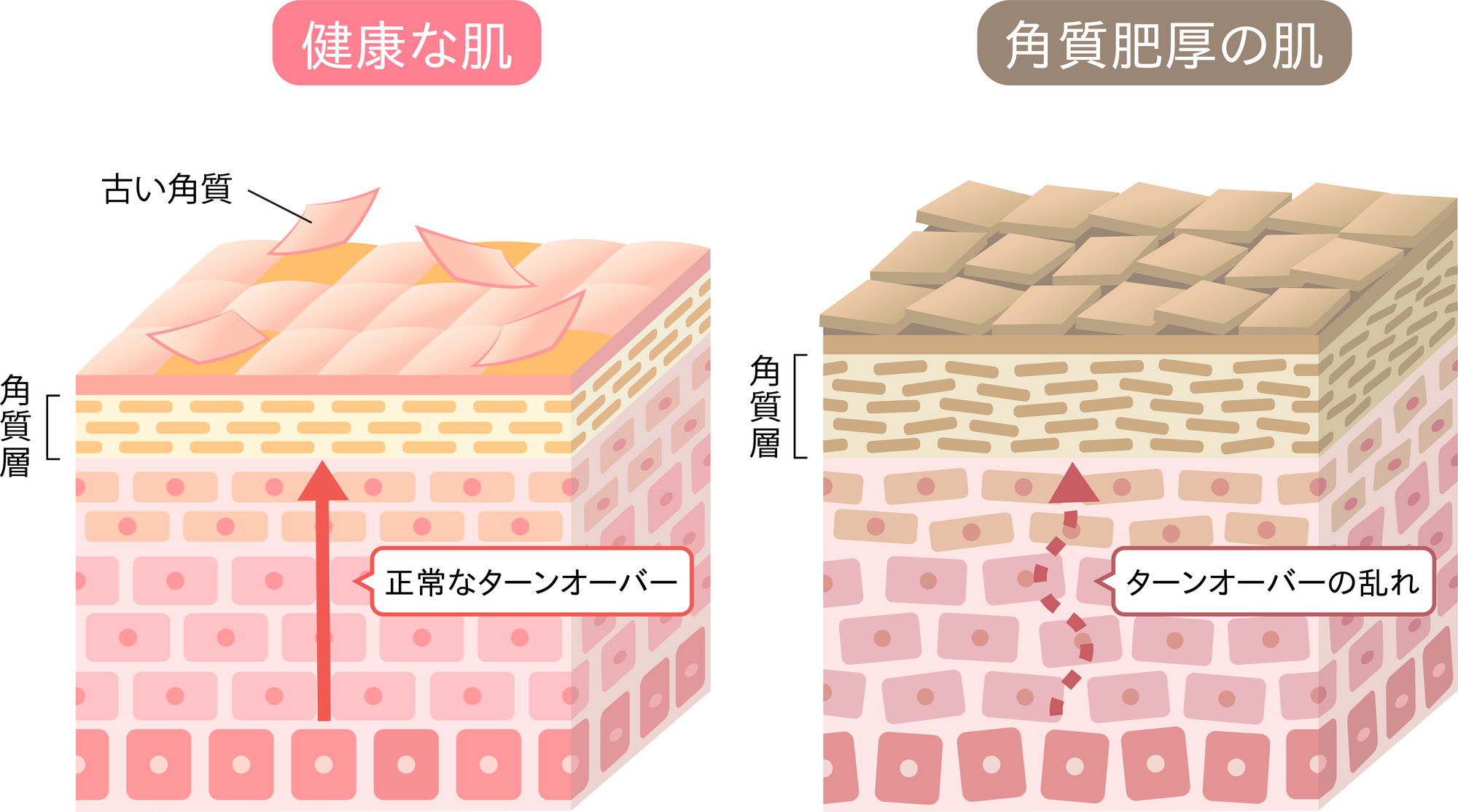 4MSKとは？美白効果やおすすめの配合化粧品を紹介 - 美肌ナビ：女性の肌悩みを解決する中立公正な情報メディア