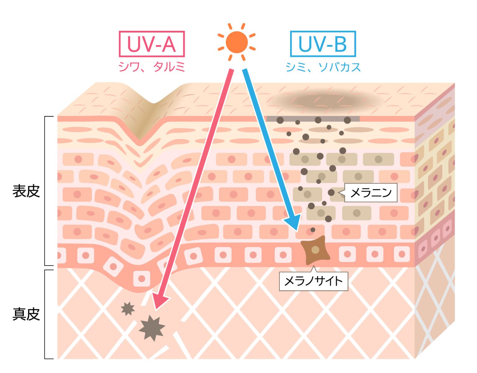 4MSKとは？美白効果やおすすめの配合化粧品を紹介 - 美肌ナビ：女性の肌悩みを解決する中立公正な情報メディア